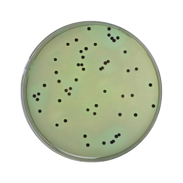 Hektoen Enteric Agar Shigella