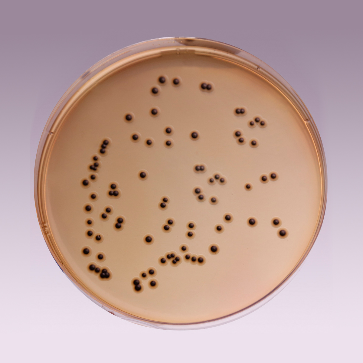 Agar Ss Salmonella Shigella