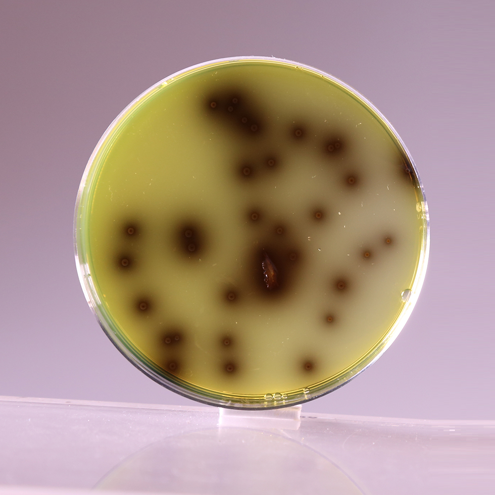 Oxford Agar Oxford Listeria Selective Supplement Microbiology